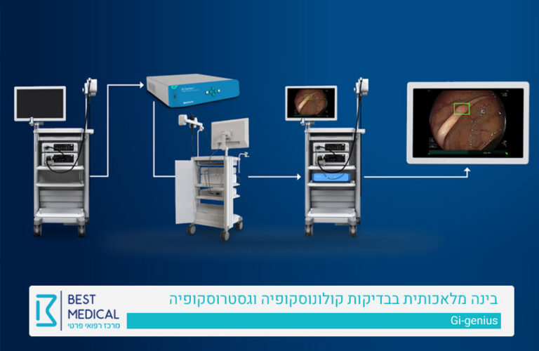 בינה מלאכותית - בדיקות קולונוסקופיה וגסטרוסקופיה - Gi genius - בסט ...